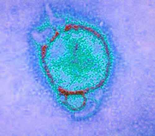 Hendra virus: creato il primo vaccino